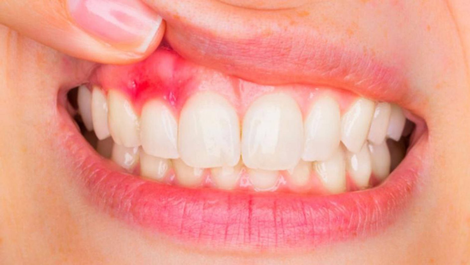 Parodontologija - Ars Dentalis